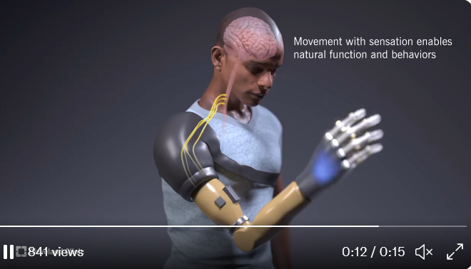 Cleveland Clinic researchers have engineered a first-of-its-kind bionic ...